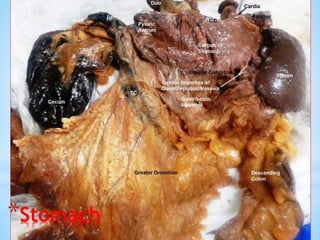 Surgical Anatomy of Cadaveric Abdominal Viscera - Dr Sanjoy Sanyal ...