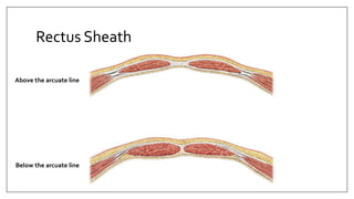Surgical anatomy of anterior abdominal wall and inguinal | PPTX
