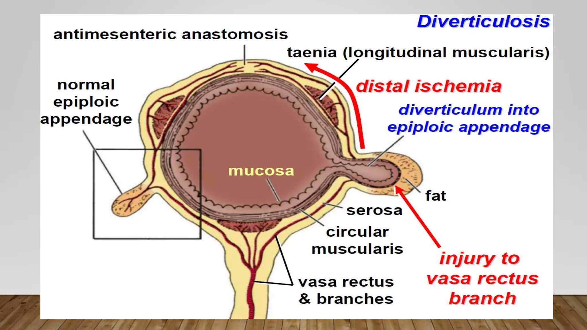 surgical anatomy of large bowel and appendix.pptx