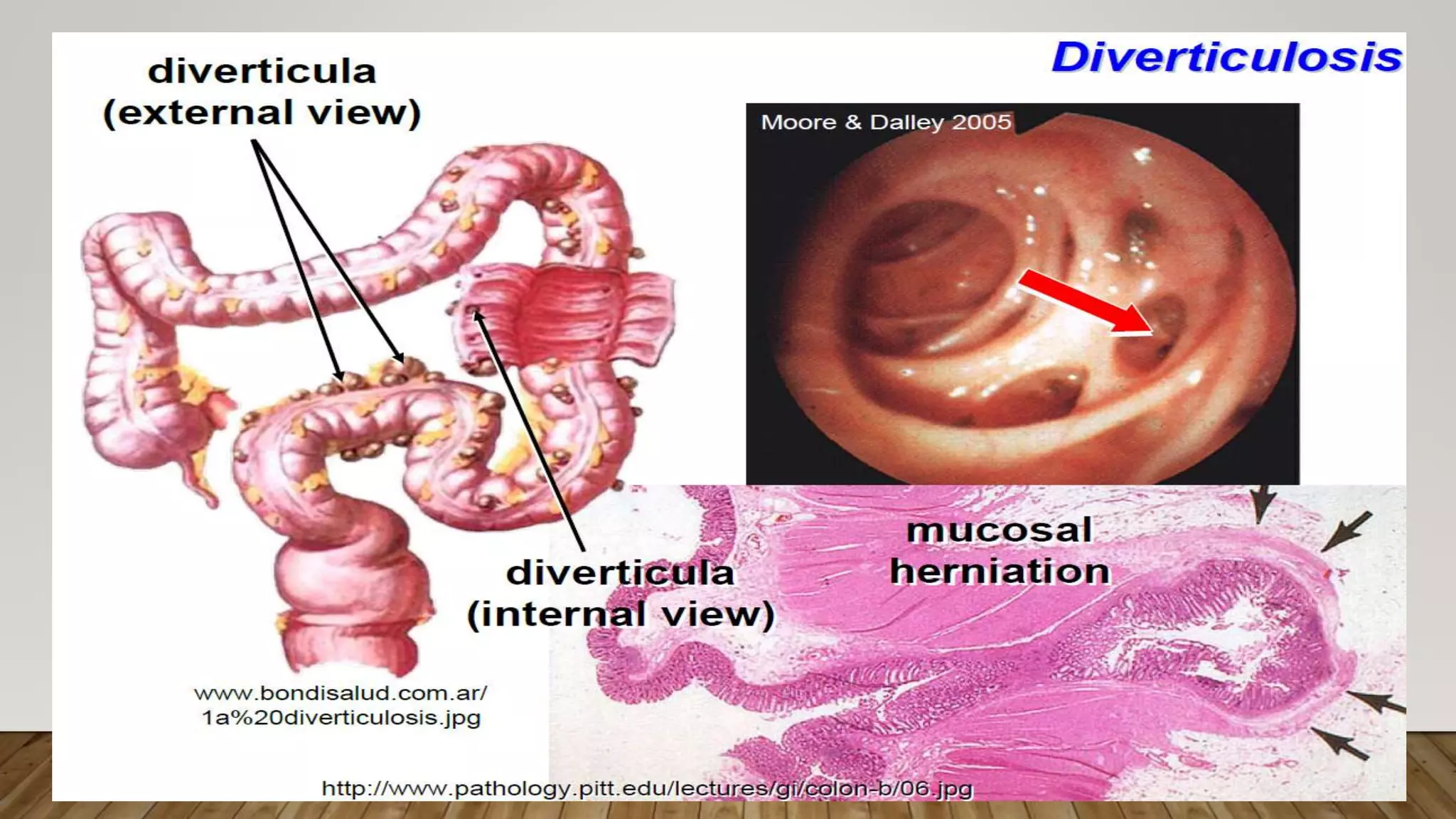surgical anatomy of large bowel and appendix.pptx