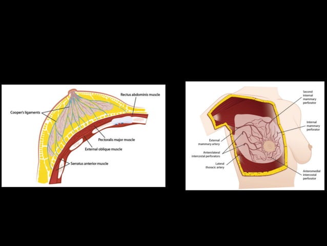 Surgical anatomy of breasts Surgical anatomy of breasts