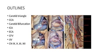 Surgical anatomy of carotid endartrectomy by Dr.Mumtaz Ali.pptx