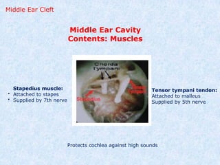 Surgical Anatomy of Ear.pptxxxxxxxxxxxx imp | PPTX