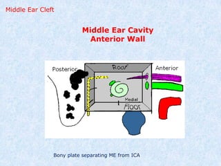 Surgical Anatomy of Ear.pptxxxxxxxxxxxx imp | PPTX