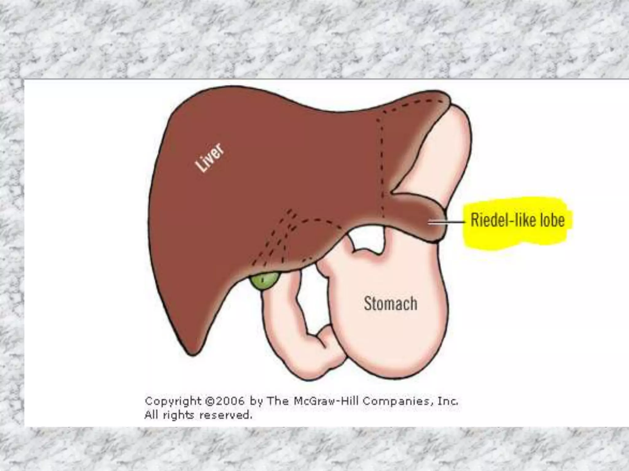 Surgical anatomy of hepatobiliary system by biswajit deka | PPTX