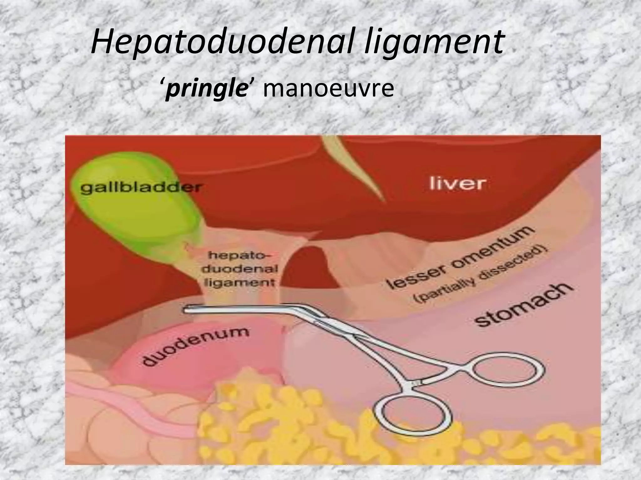 Surgical anatomy of hepatobiliary system by biswajit deka | PPTX