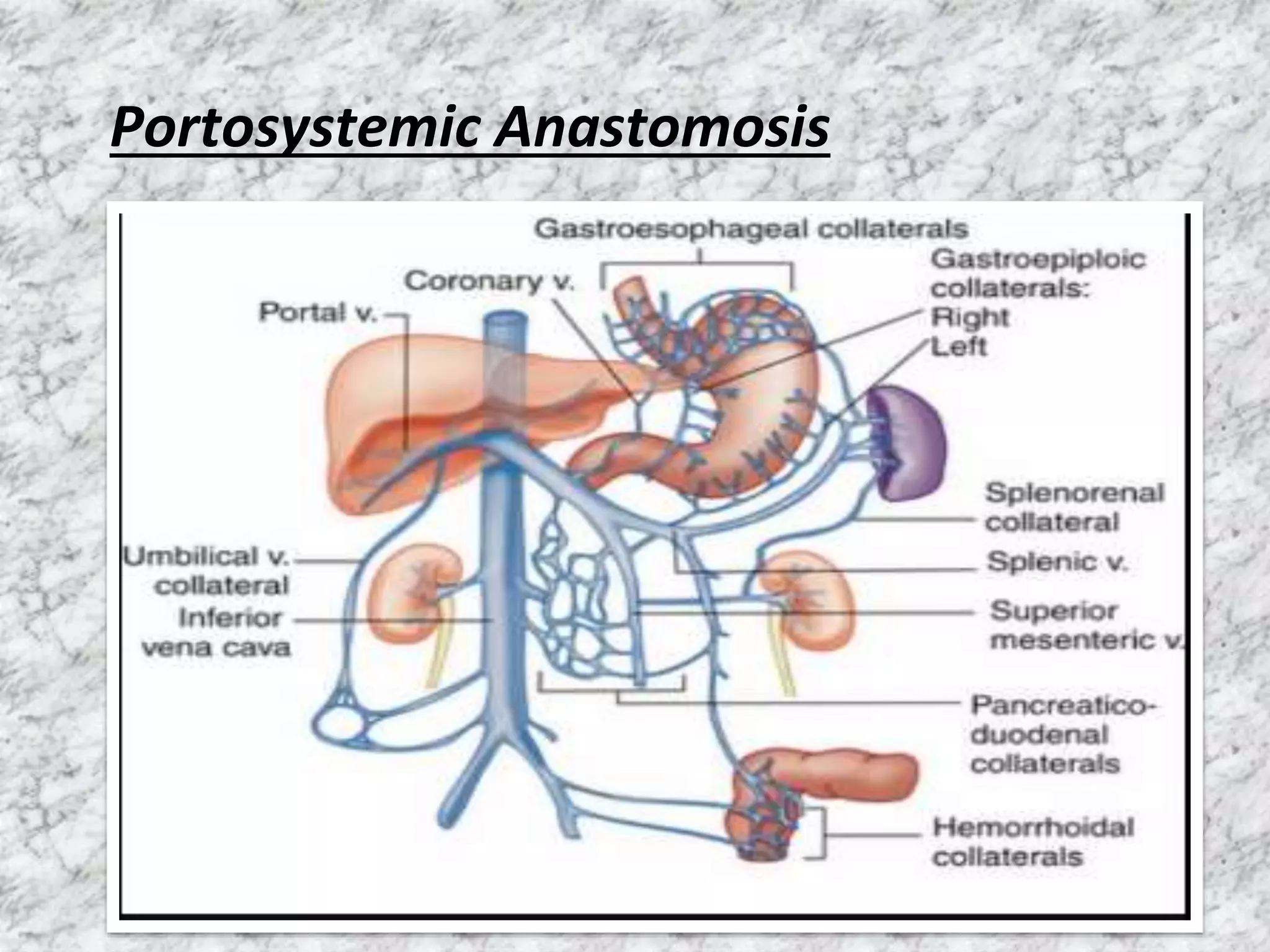 Surgical anatomy of hepatobiliary system by biswajit deka | PPTX ...