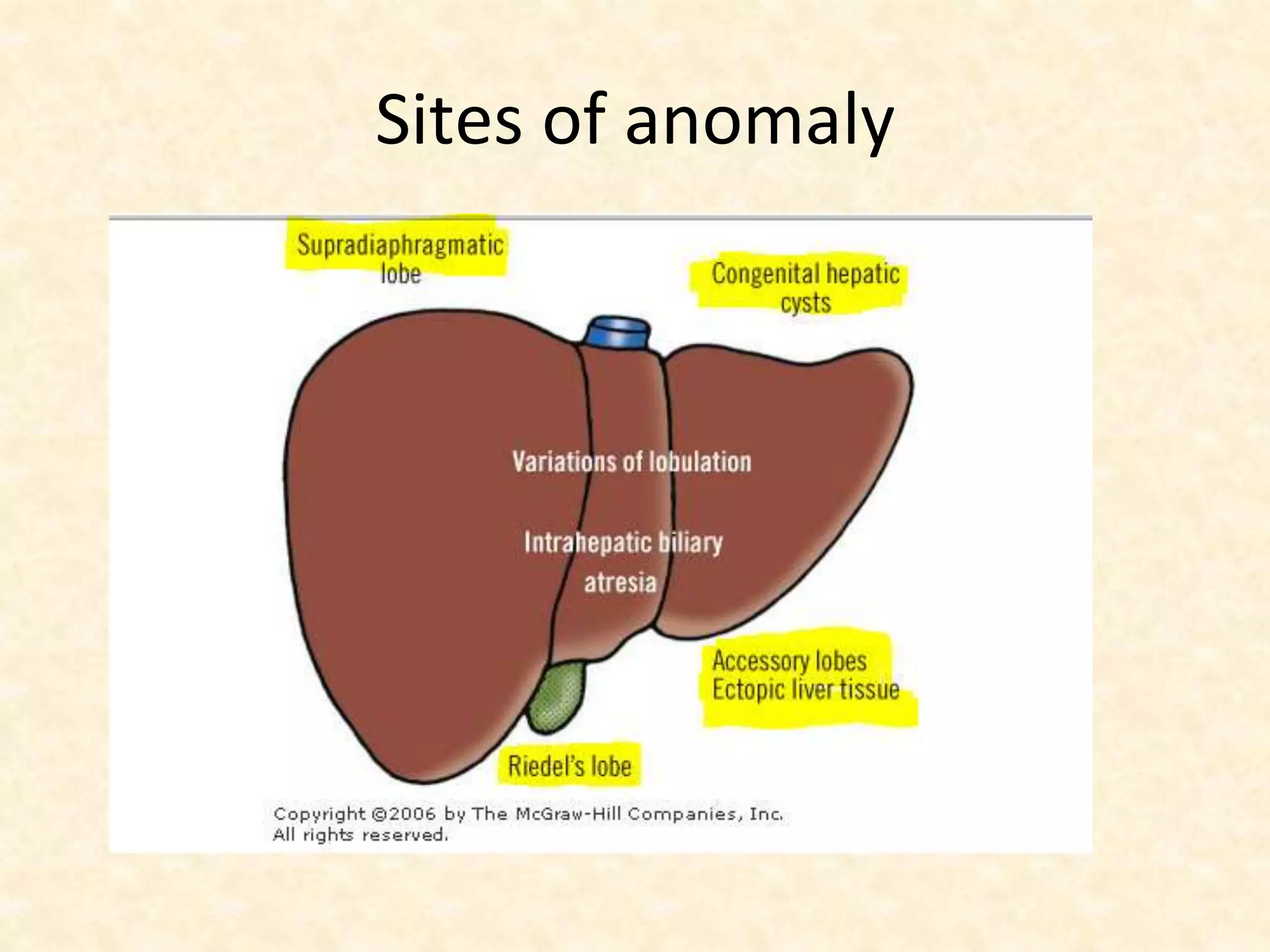 Surgical anatomy of hepatobiliary system by biswajit deka | PPTX