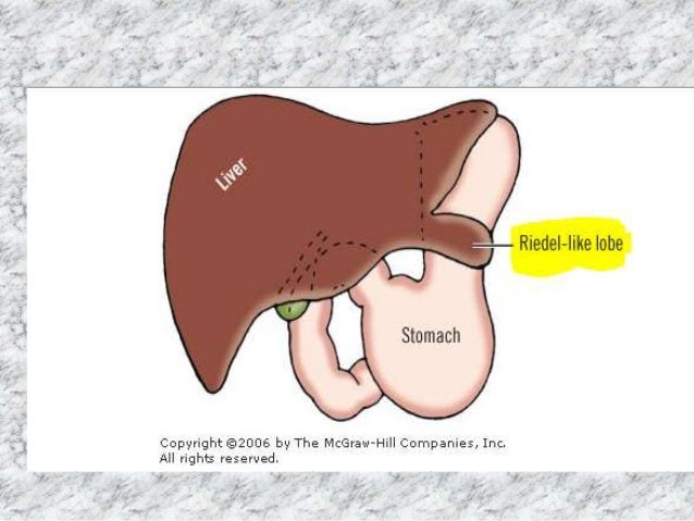 Surgical anatomy of hepatobiliary system by biswajit deka