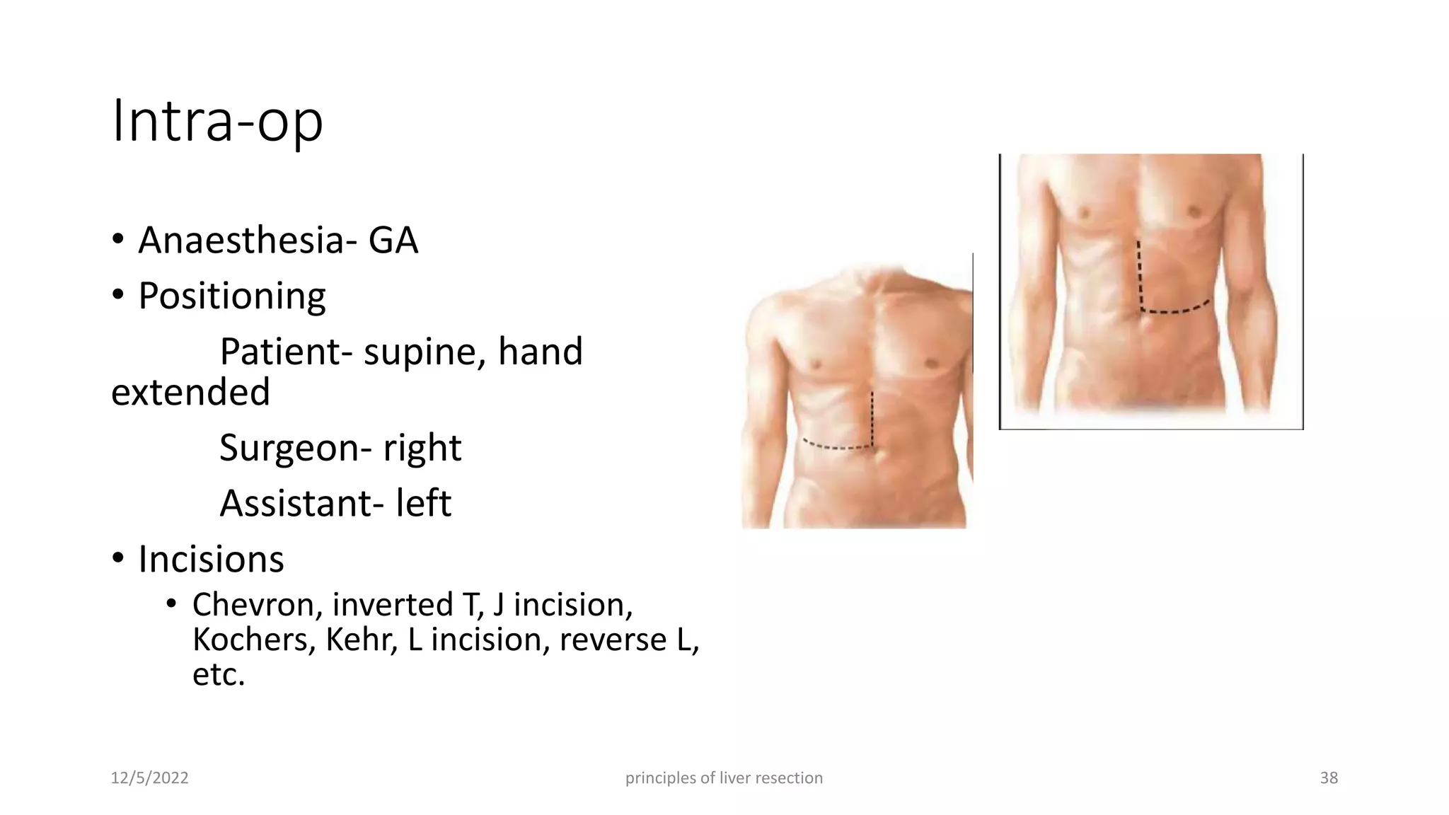 Surgical anatomy of Liver, Pancreas, Biliary tree and Principle of ...