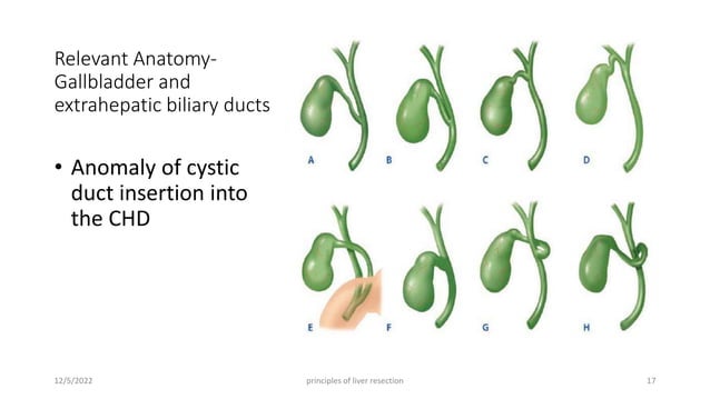 Surgical anatomy of Liver, Pancreas, Biliary tree and Principle of ...