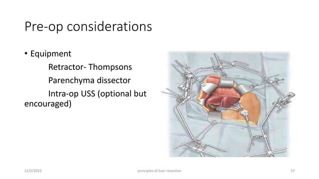 Surgical anatomy of Liver, Pancreas, Biliary tree and Principle of ...