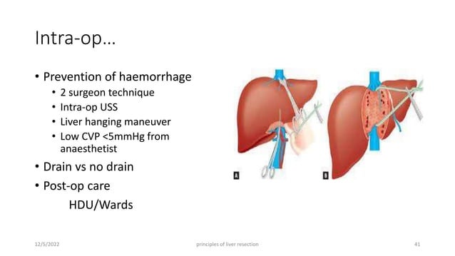 Surgical anatomy of Liver, Pancreas, Biliary tree and Principle of ...