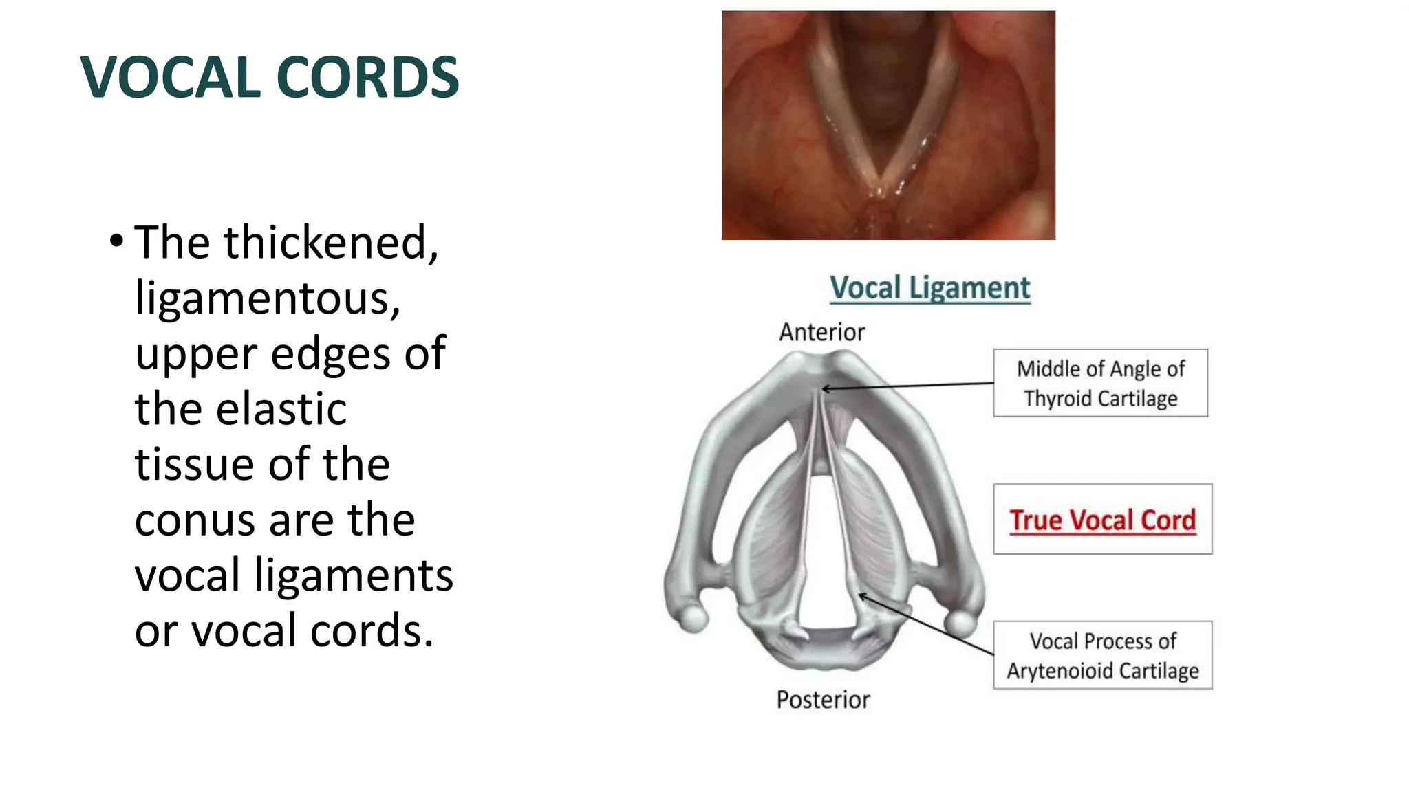 SURGICAL ANATOMY OF LARYNX.pptx by Dr Laraib | PPTX