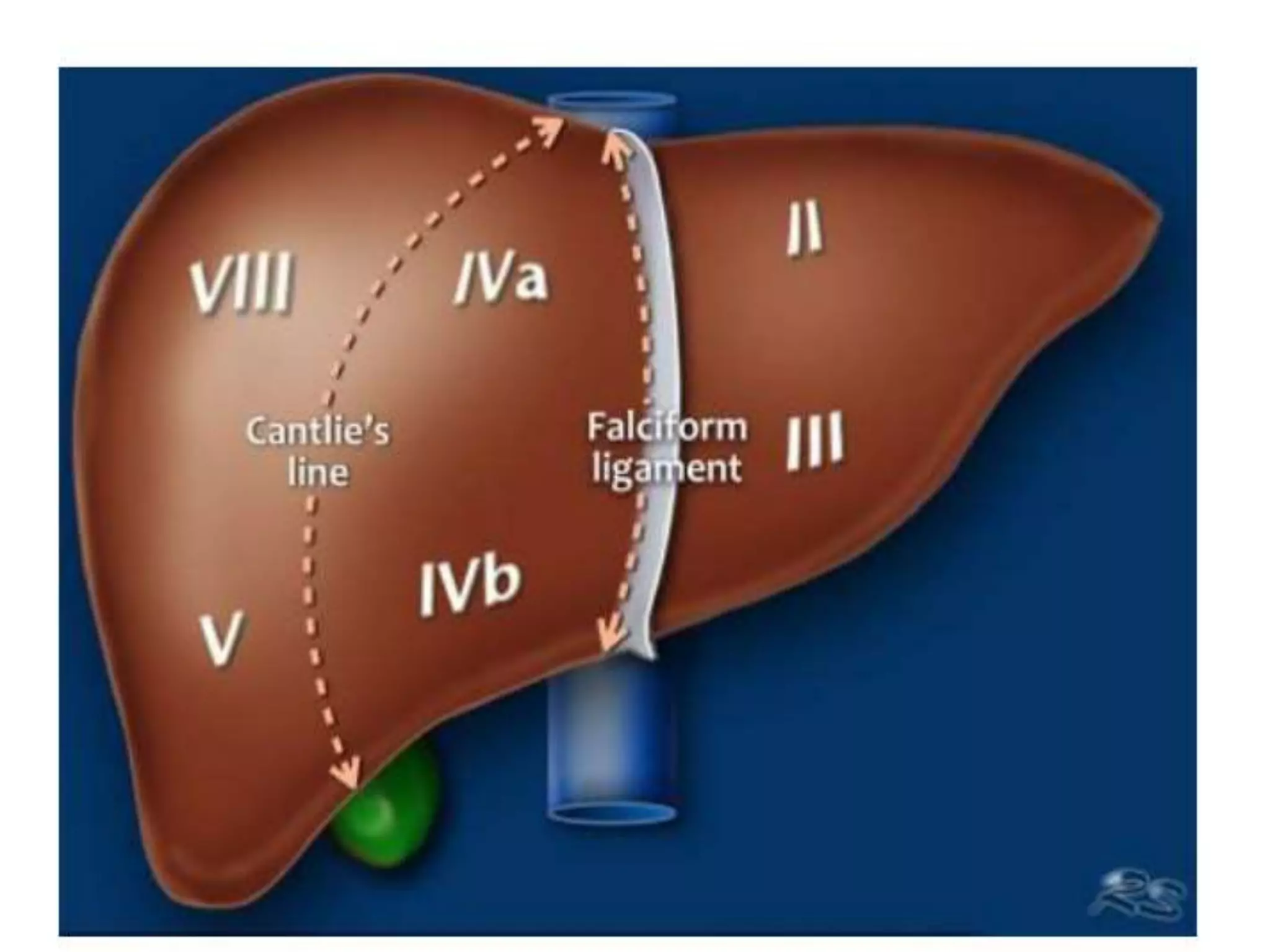 Surgical anatomy of liver | PPTX