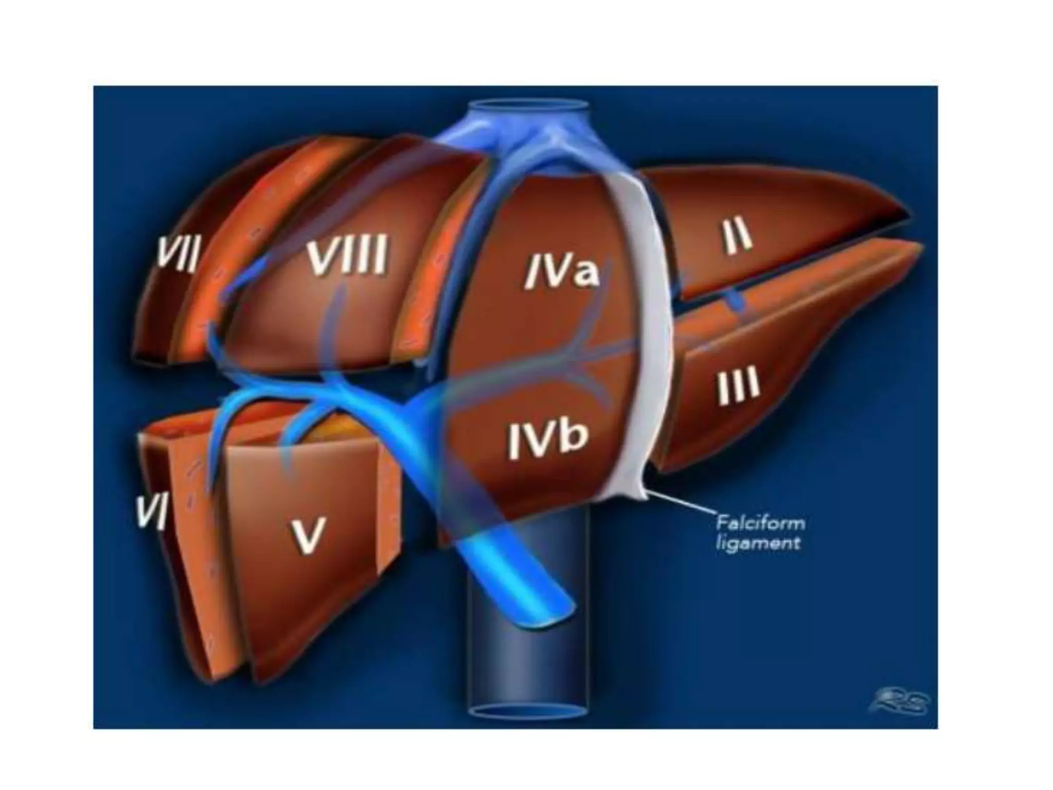 Surgical anatomy of liver | PPTX