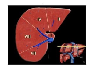 Surgical anatomy of liver | PPTX