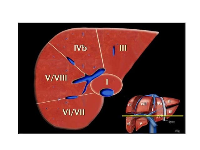 Surgical anatomy of liver | PPTX