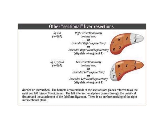 Surgical anatomy of liver | PPTX