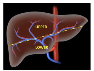 Surgical anatomy of liver | PPTX