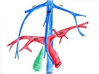 Surgical anatomy of liver | PPTX