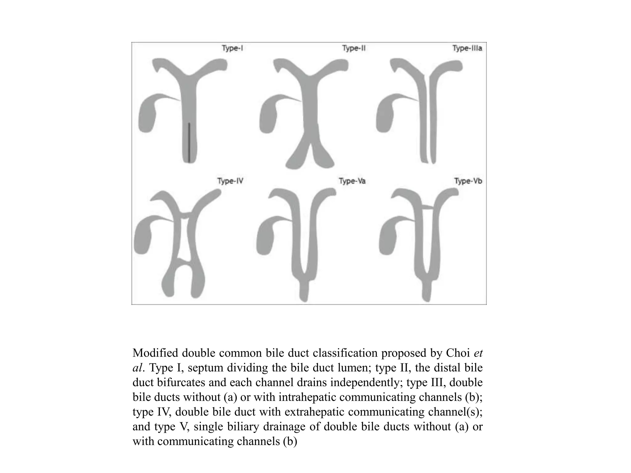 Surgical anatomy of liver.dr quiyum | PPTX | Digestive Disorders ...