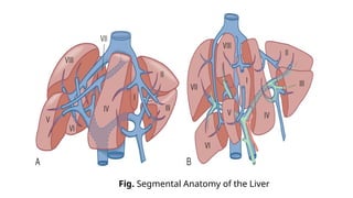 Surgical Anatomy of Liver in detail for undergraduate | PPTX