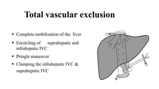 Surgical anatomy of Liver, Concept of liver.pptx