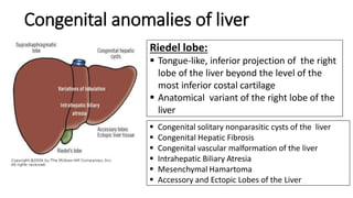 Surgical anatomy of Liver, Concept of liver.pptx