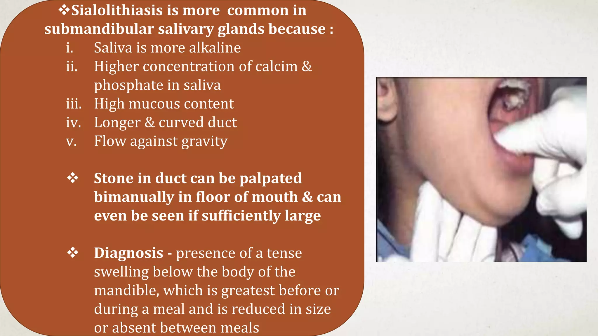 Surgical anatomy of major salivary glands | PPTX