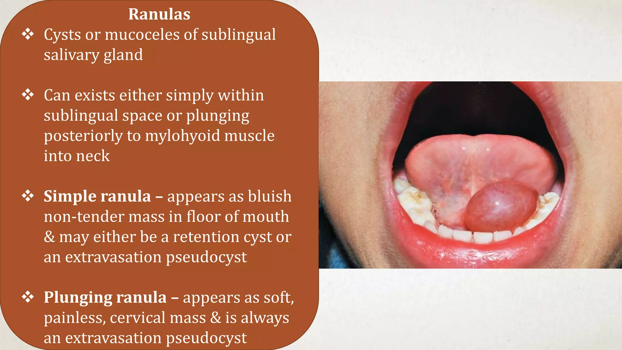 Surgical anatomy of major salivary glands | PPTX