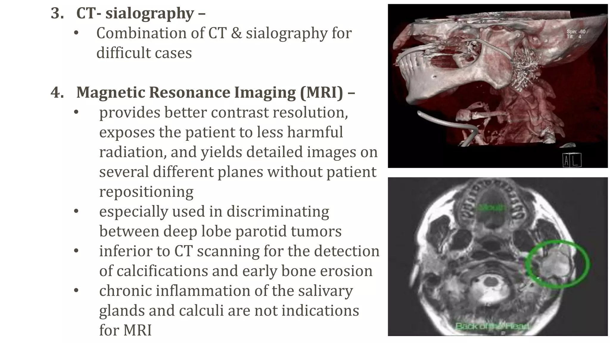Surgical anatomy of major salivary glands | PPTX
