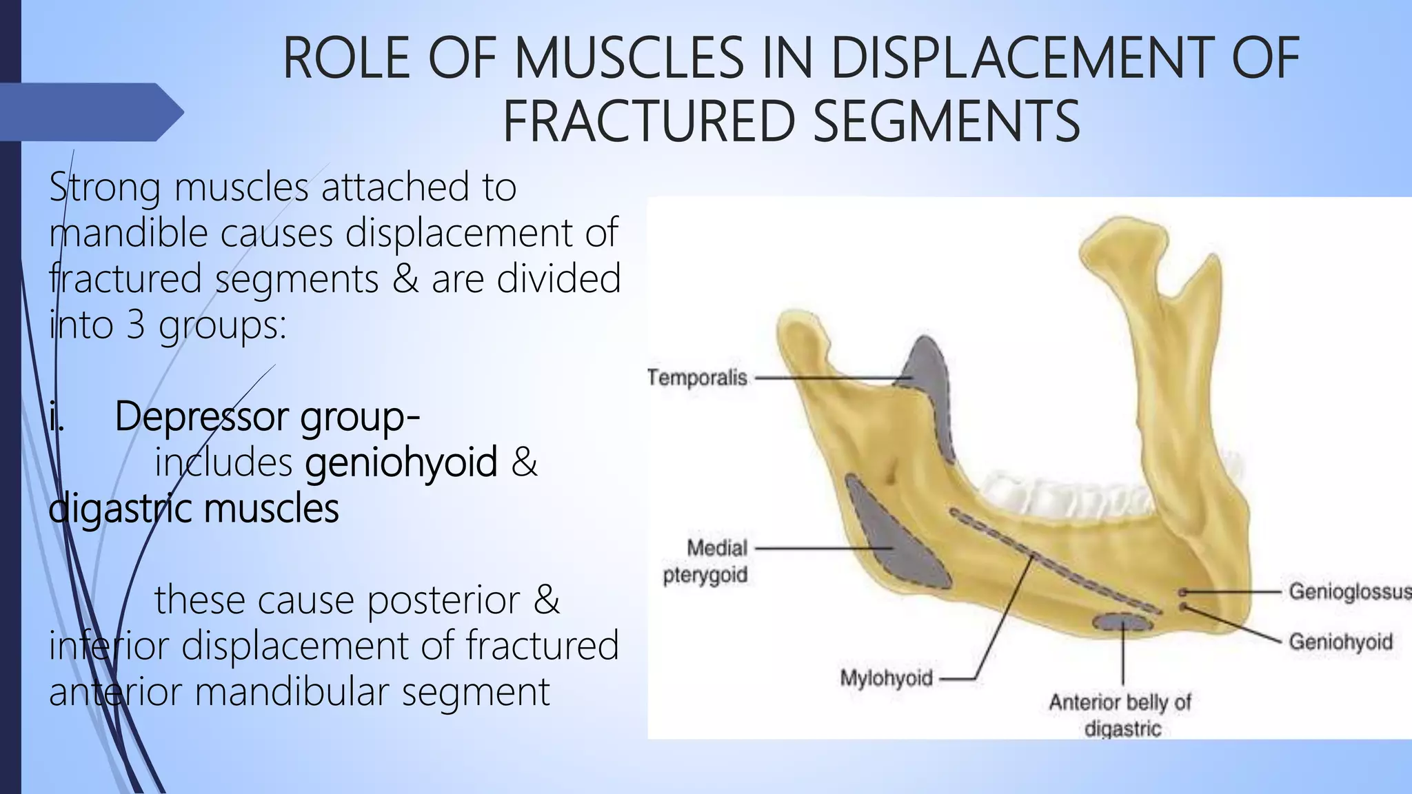 Surgical anatomy of mandible | PPTX
