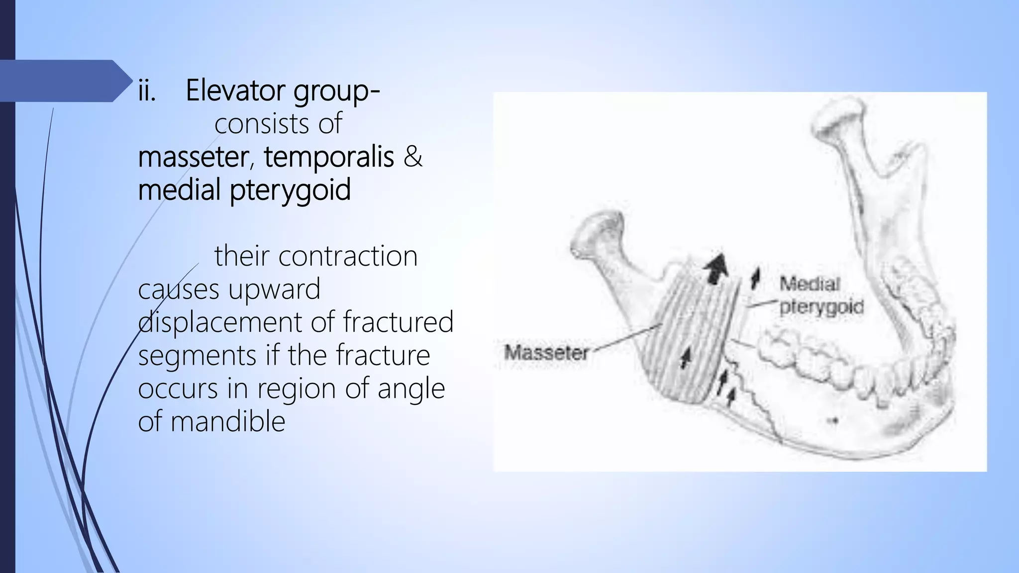 Surgical anatomy of mandible | PPTX