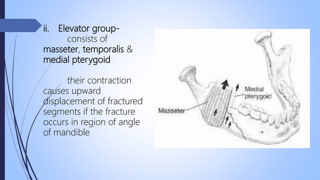 Surgical anatomy of mandible | PPTX | Death, Injury, or Military ...