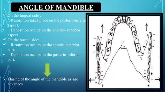 SURGICAL ANATOMY OF MANDIBLE.pptx | Bone and Joint Conditions ...