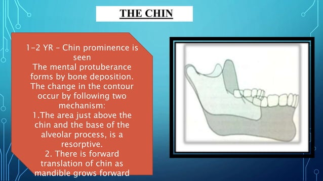 SURGICAL ANATOMY OF MANDIBLE.pptx | Bone and Joint Conditions | Diseases and Conditions