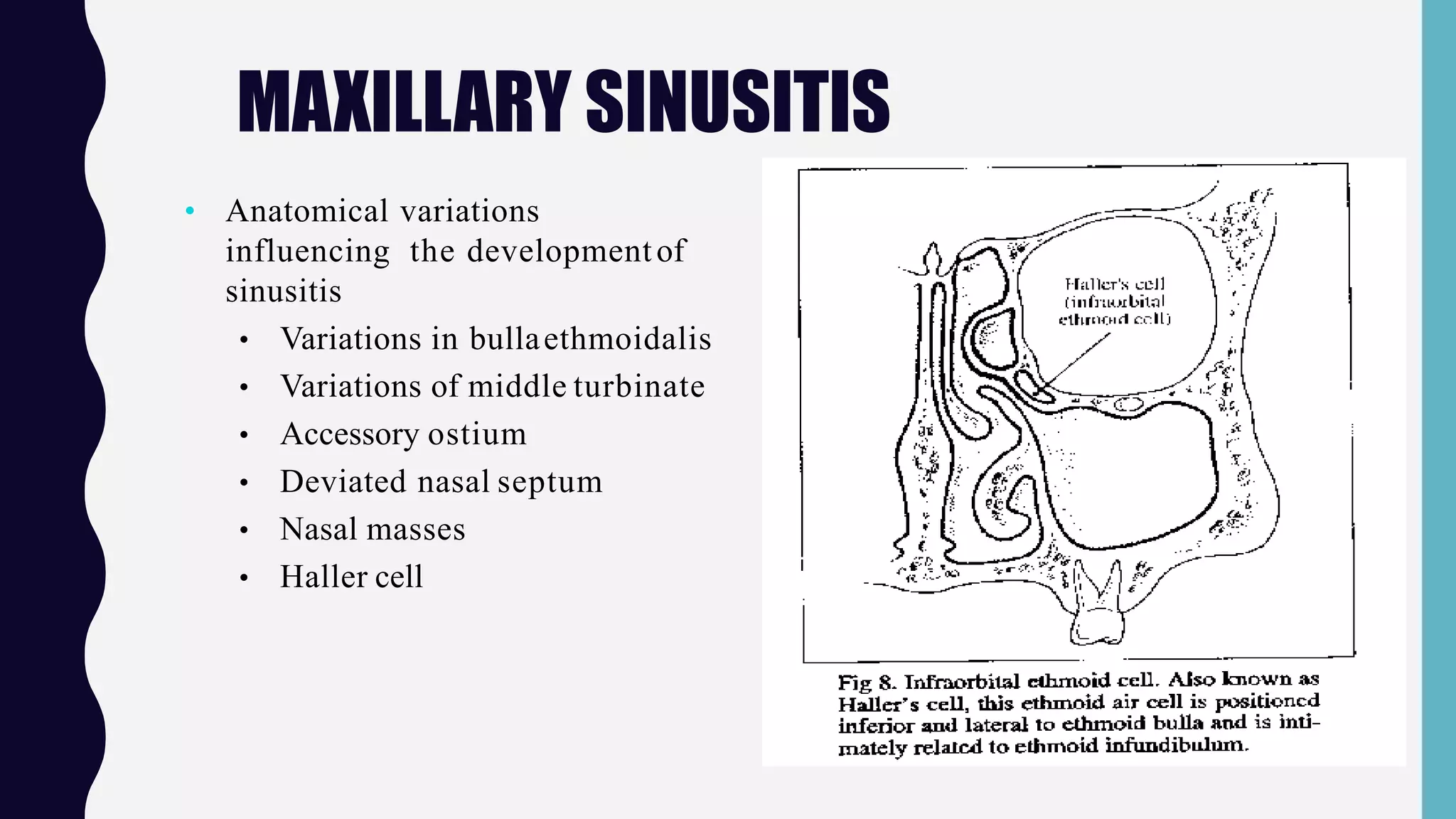 Surgical anatomy of maxillary sinus | PPTX