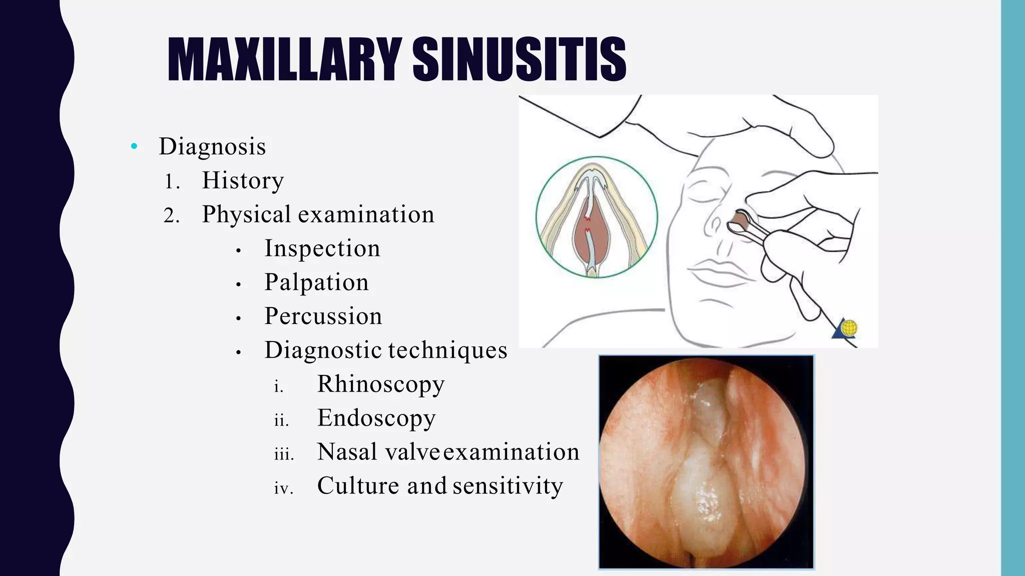 Surgical anatomy of maxillary sinus | PPTX