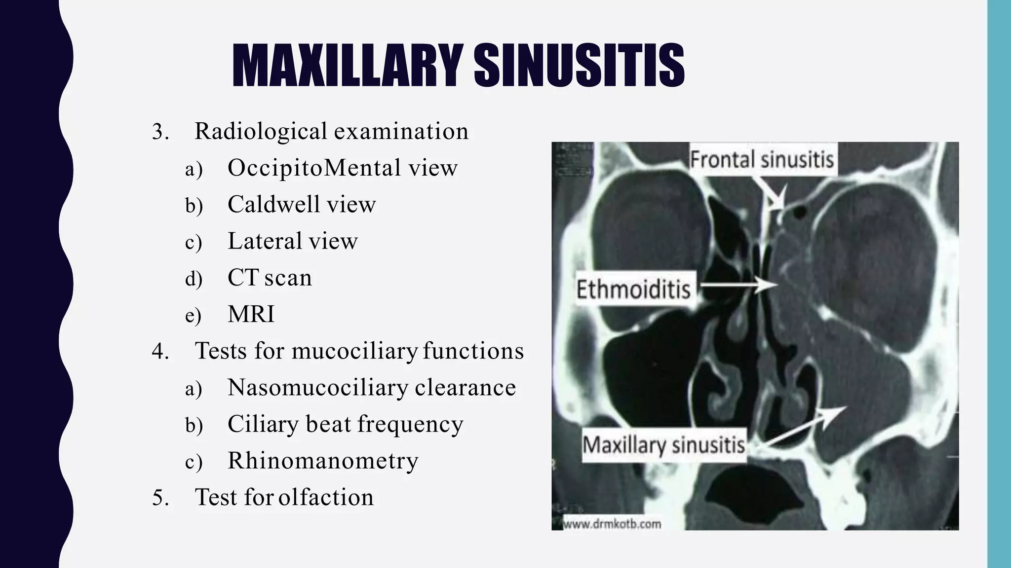 Surgical anatomy of maxillary sinus | PPTX Surgical anatomy of maxillary sinus | PPTX