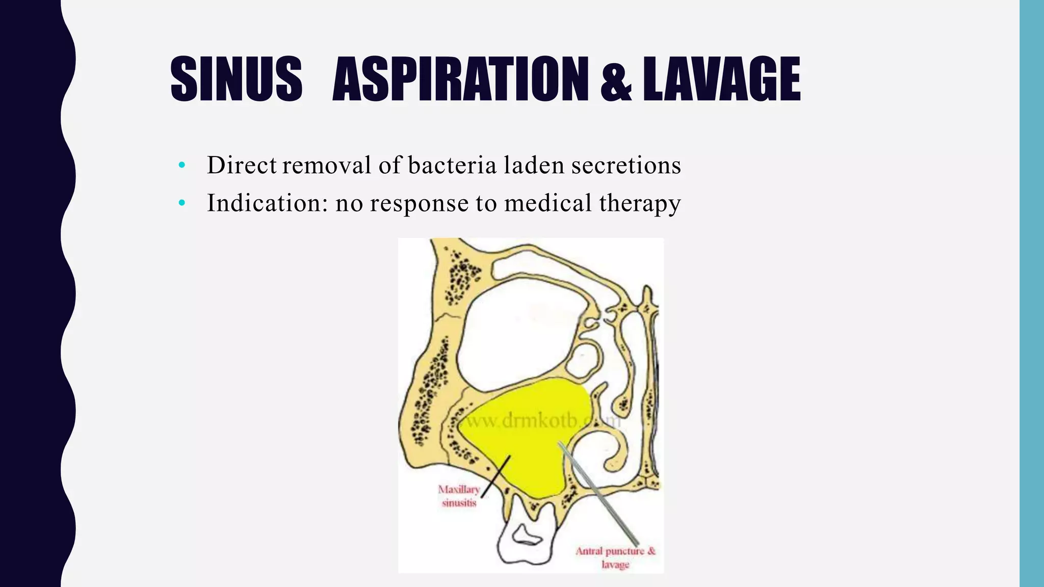 Surgical anatomy of maxillary sinus | PPTX