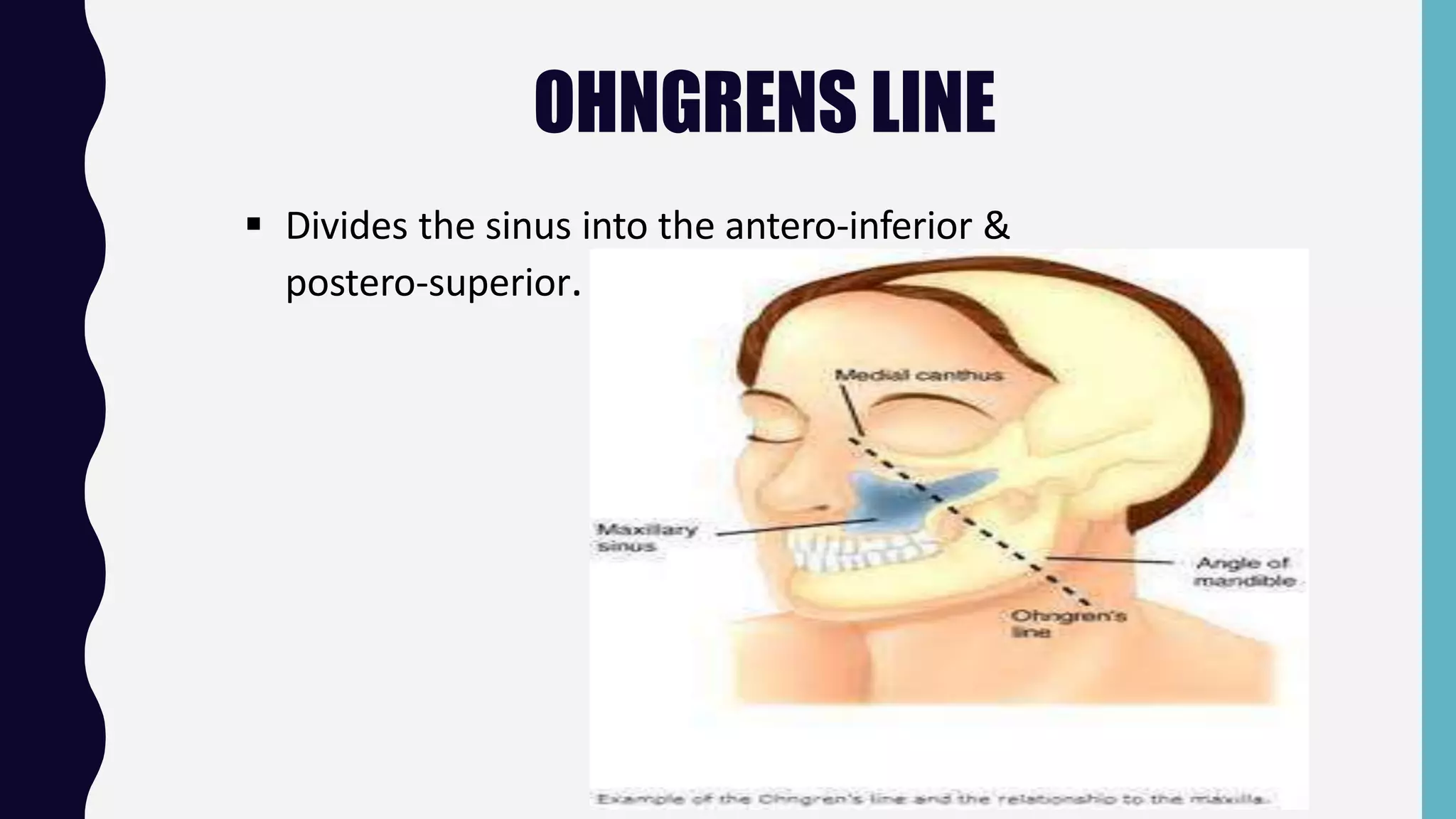 Surgical anatomy of maxillary sinus | PPTX