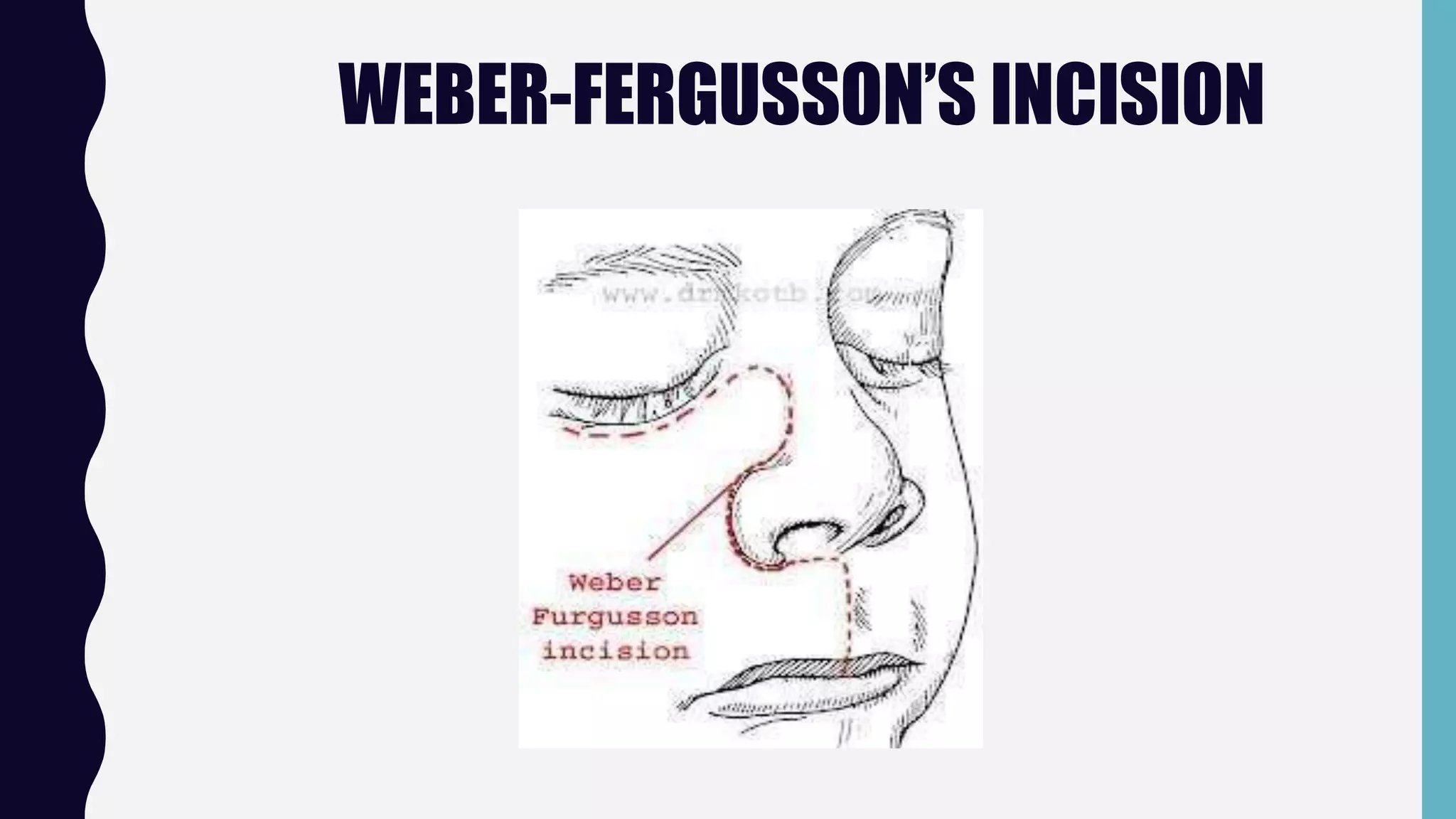 Surgical anatomy of maxillary sinus | PPTX