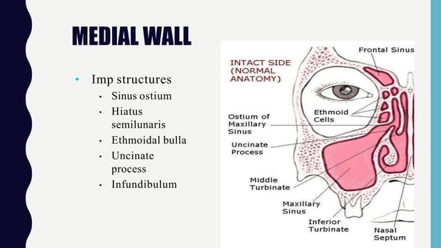 Surgical anatomy of maxillary sinus | PPTX