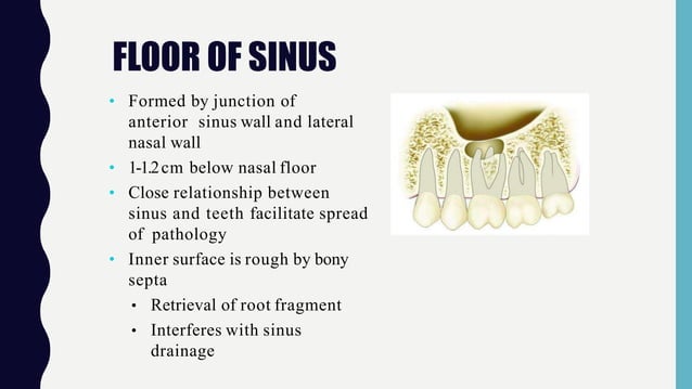 Surgical anatomy of maxillary sinus | PPTX