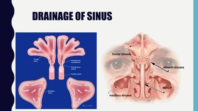 Surgical anatomy of maxillary sinus | PPTX