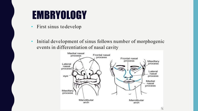 Surgical anatomy of maxillary sinus | PPTX