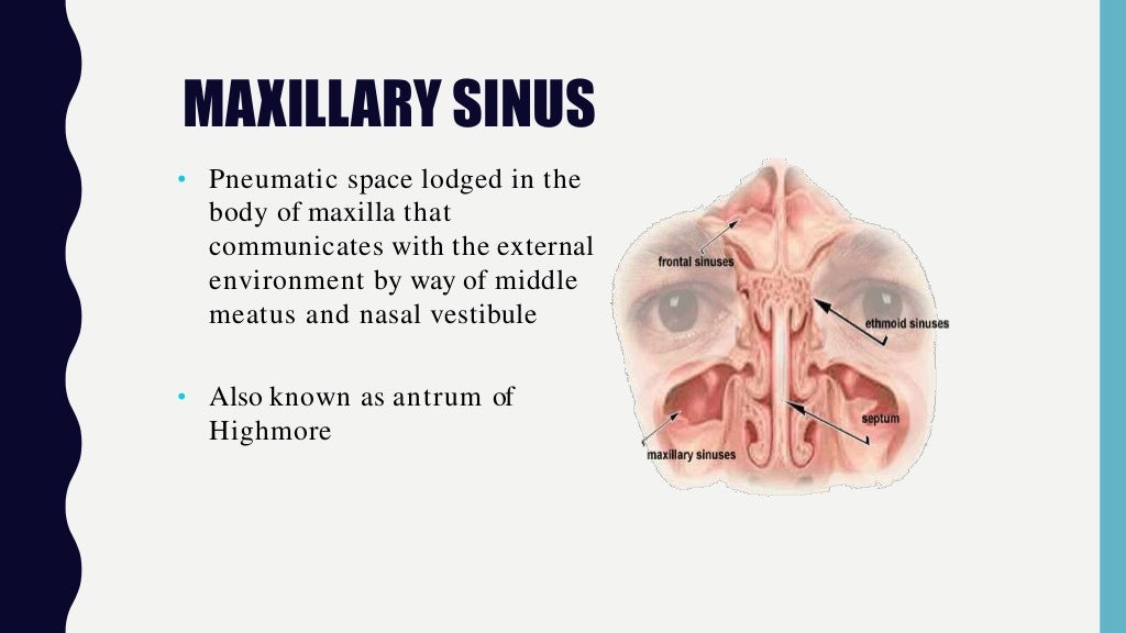 Surgical anatomy of maxillary sinus