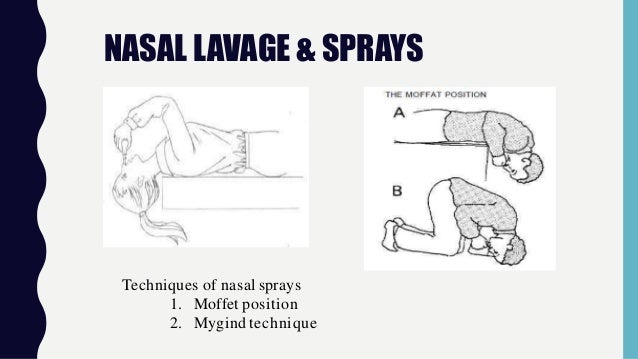 Surgical anatomy of maxillary sinus