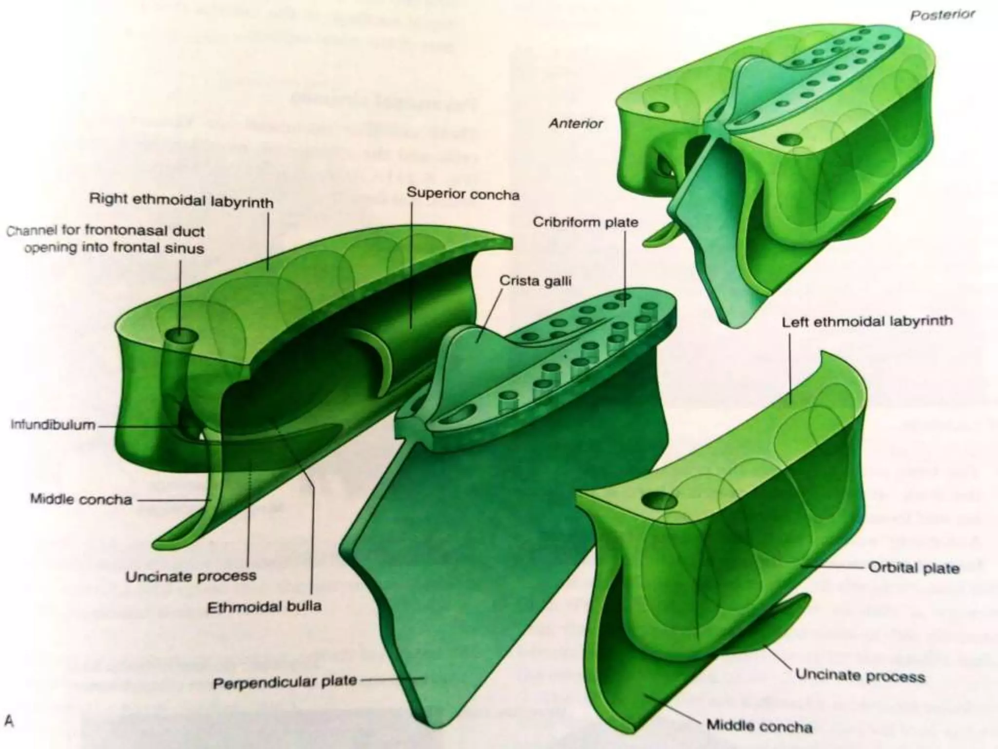 Surgical anatomy of Maxillary Sinus , Lateral wall of nose and Soft ...